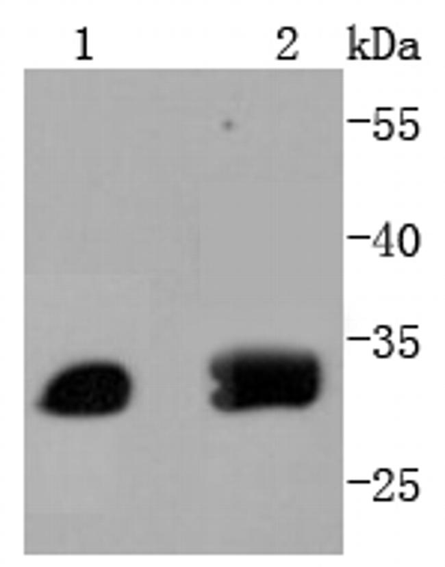 ATF5 Antibody (MA5-32365)