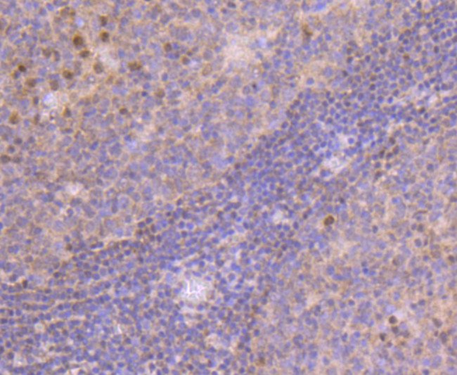 MGMT Antibody (MA5-32461)