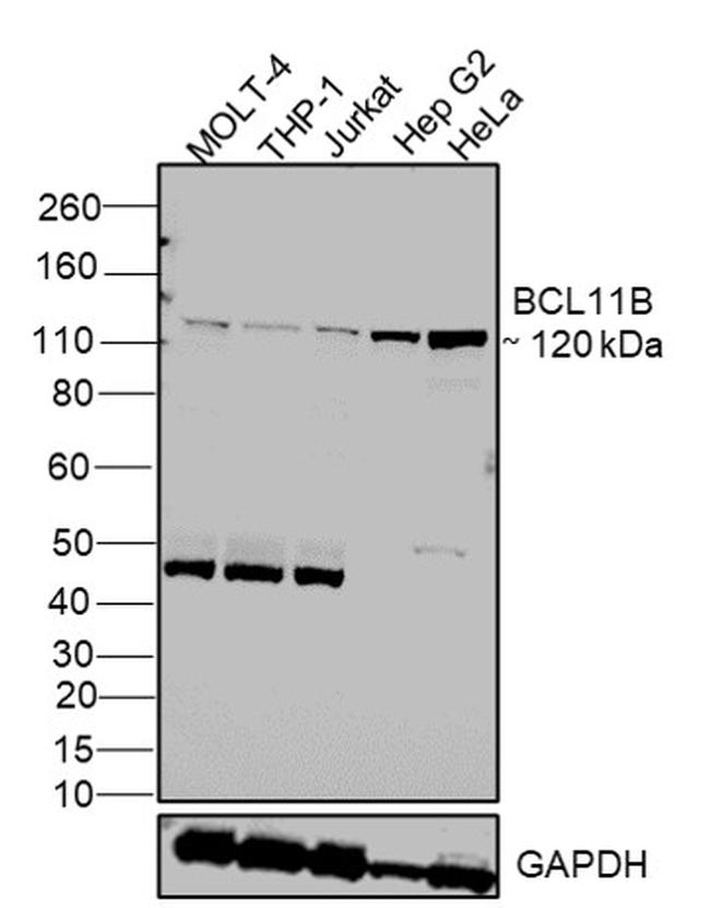 BCL11B Recombinant Monoclonal Antibody (JF09-90) (MA5-32546)