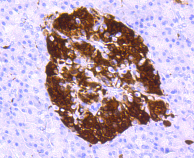 PGP9.5 Antibody (MA5-32583)