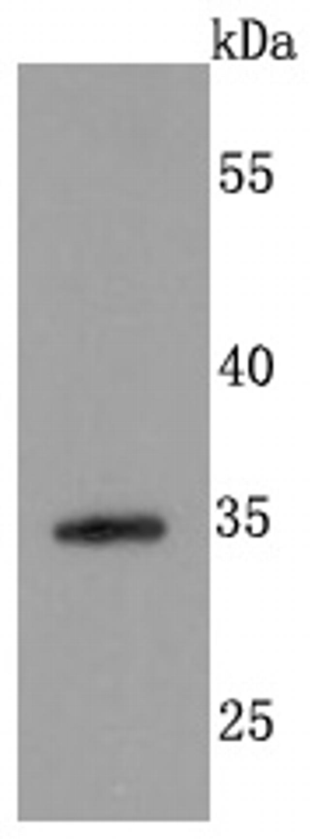 CD138 Antibody (MA5-32600)