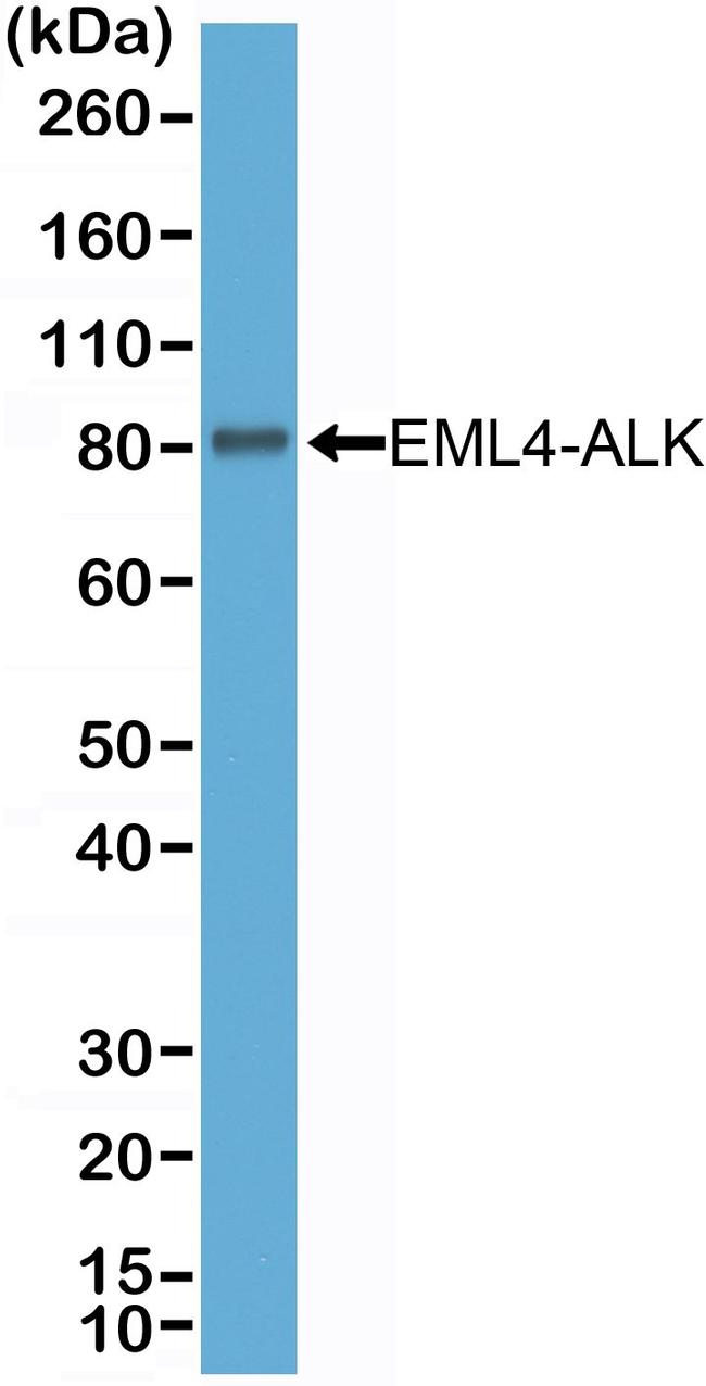 ALK Antibody (MA5-33093)
