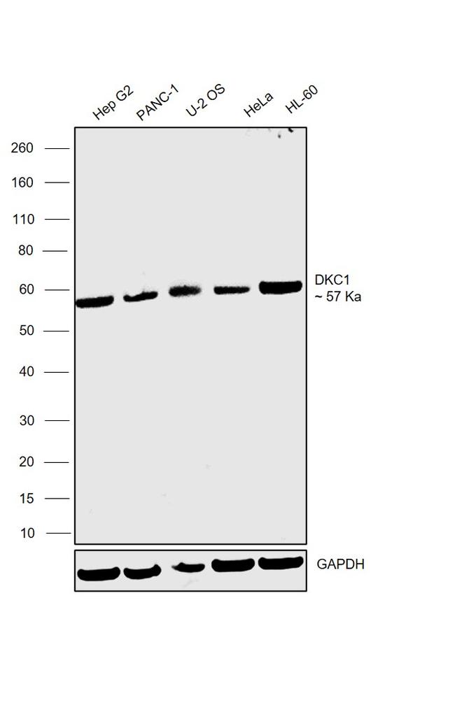 DKC1 Recombinant Monoclonal Antibody (JU34-32) (MA5-34640)