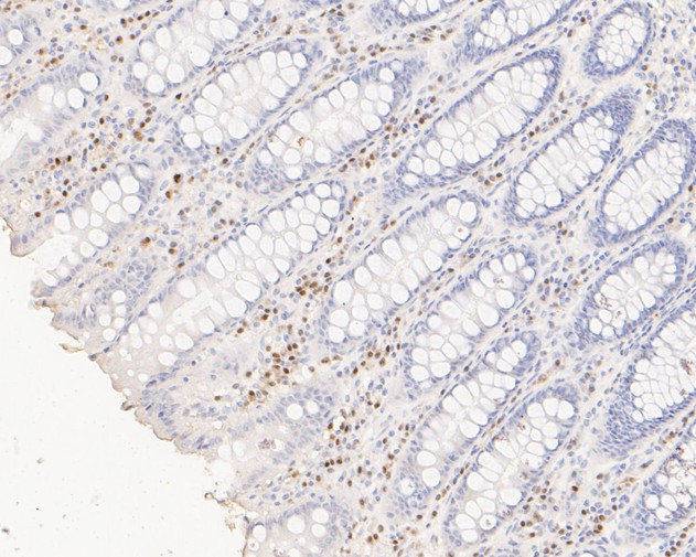 MUM1 Antibody (MA5-36167)