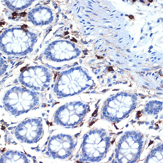 Mast Cell Tryptase Antibody (MA5-38007)