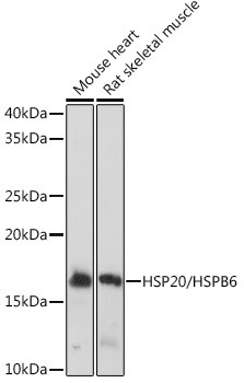 HSP20 Recombinant Monoclonal Antibody (ARC1787) (MA5-38182)