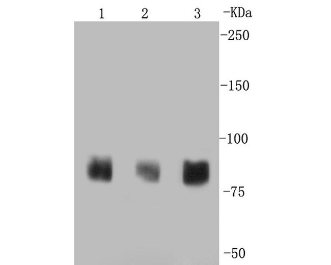 PSD-95 Recombinant Monoclonal Antibody (SR38-09) (MA5-41092)