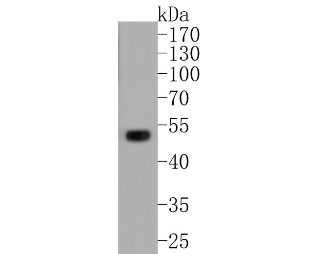 RAGE Antibody (MA5-41206)