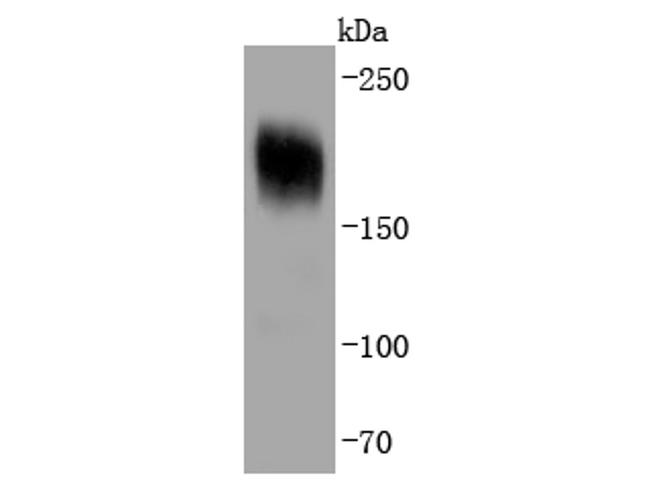 PDGFRA Antibody (MA5-41209)