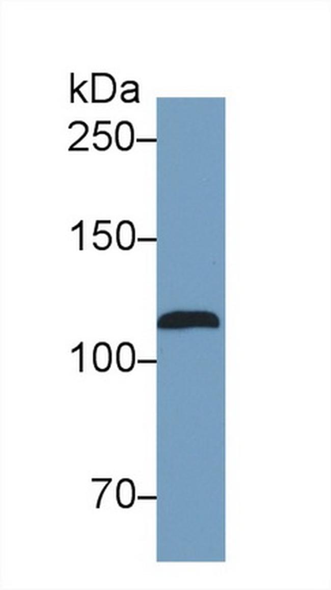 iNOS Monoclonal Antibody (C1) (MA5-41652)