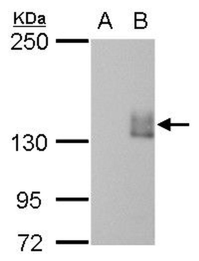 mCherry Antibody (MA5-42333)