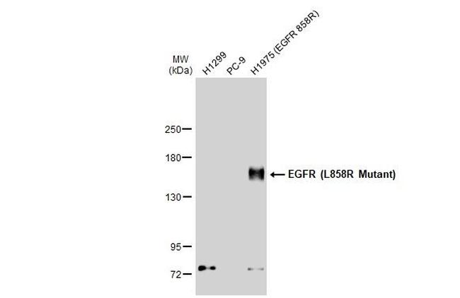 EGFR (L858R Mutant) Recombinant Monoclonal Antibody (HL1022) (MA5-42358)
