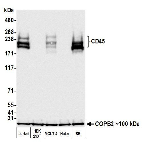 CD45 Recombinant Monoclonal Antibody (BL-178-12C7) (MA5-44219)