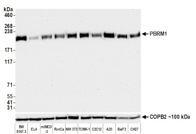 PBRM1 Recombinant Monoclonal Antibody (BL-39-2C3) (MA5-44233)