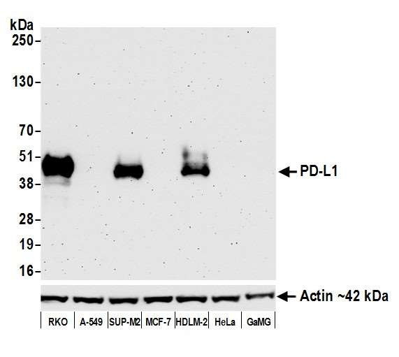 PD-L1 (CD274) Recombinant Monoclonal Antibody (BLR020E) (MA5-44235)