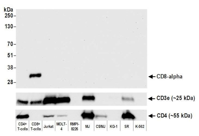 CD8 alpha Recombinant Monoclonal Antibody (BLR044F) (MA5-44283)