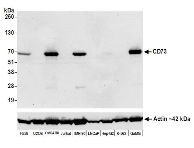 CD73 Recombinant Monoclonal Antibody (BLR054F) (MA5-44301)