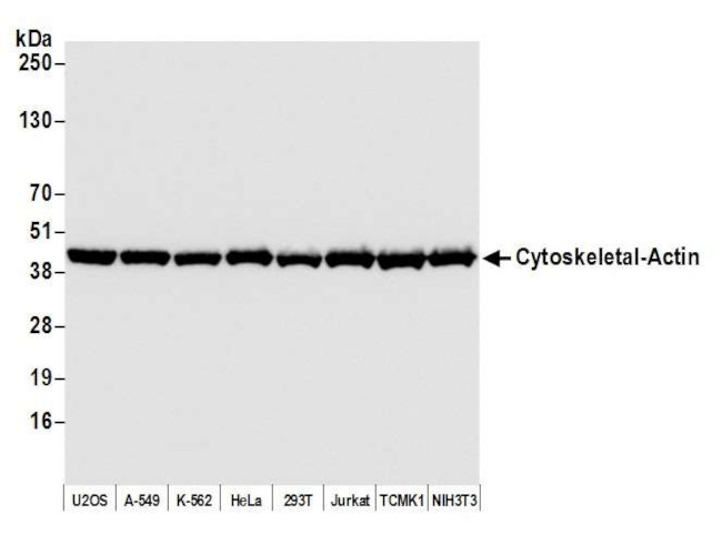 beta Actin Recombinant Monoclonal Antibody (BLR057F) (MA5-44307)