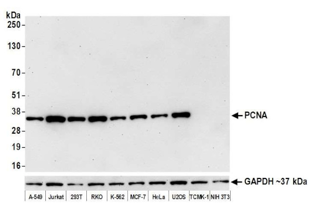PCNA Recombinant Monoclonal Antibody (BLR075G) (MA5-44341)