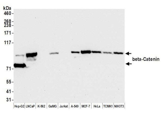 beta Catenin Recombinant Monoclonal Antibody (BLR086G) (MA5-44363)