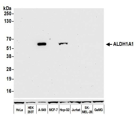 ALDH1A1 Recombinant Monoclonal Antibody (BLR089G) (MA5-44369)