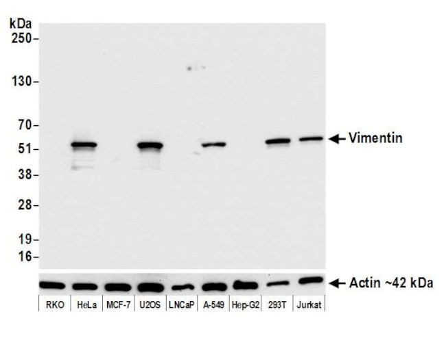 Vimentin Recombinant Monoclonal Antibody (BLR100G) (MA5-44391)