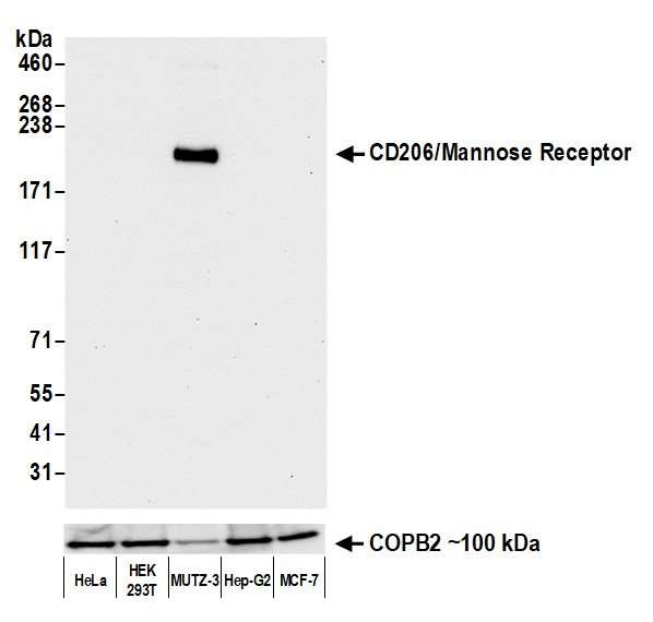 CD206 (MMR) Recombinant Monoclonal Antibody (BLR109H) (MA5-44409)