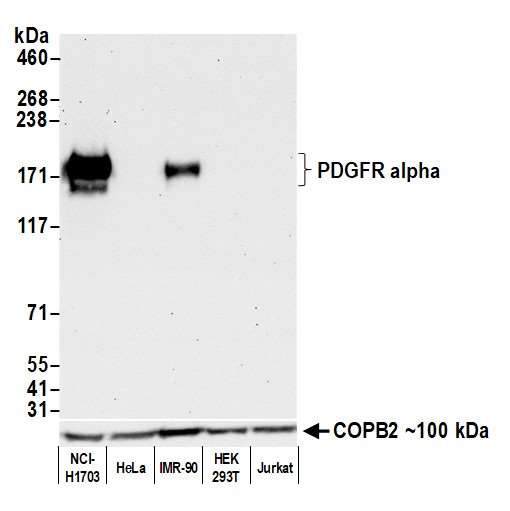 CD140a (PDGFRA) Recombinant Monoclonal Antibody (BLR128H) (MA5-44445)