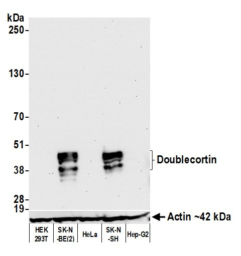 Doublecortin Recombinant Monoclonal Antibody (BLR168J) (MA5-44521)