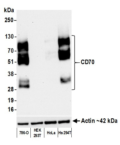 CD70 Recombinant Monoclonal Antibody (BLR176J) (MA5-44537)