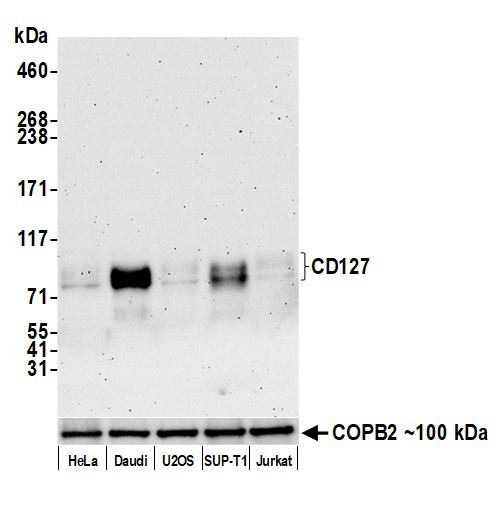 CD127 Recombinant Monoclonal Antibody (BLR177J) (MA5-44539)