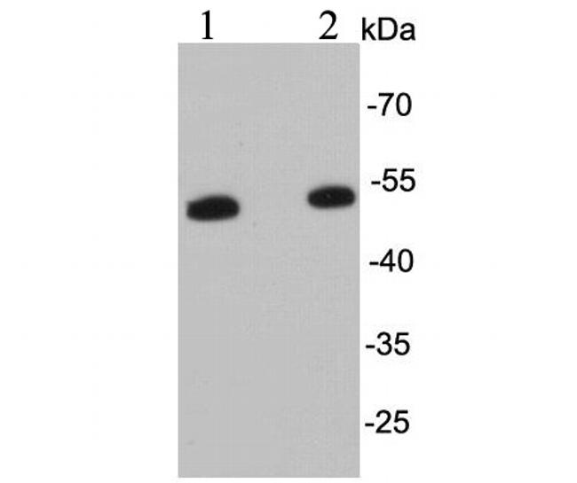 Desmin Monoclonal Antibody (3-F7) (MA5-44620)
