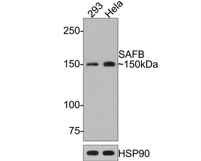 SAFB Recombinant Monoclonal Antibody (JE64-94) (MA5-44723)