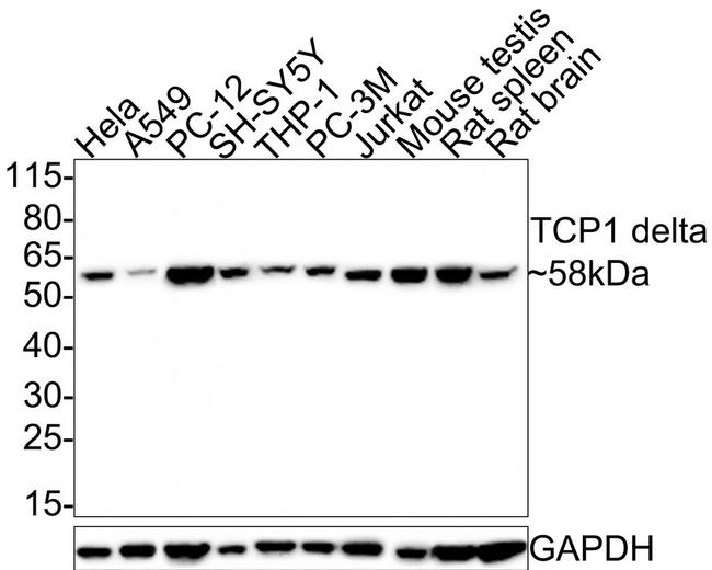 TCP-1 delta Monoclonal Antibody (A8E2) (MA5-44927)