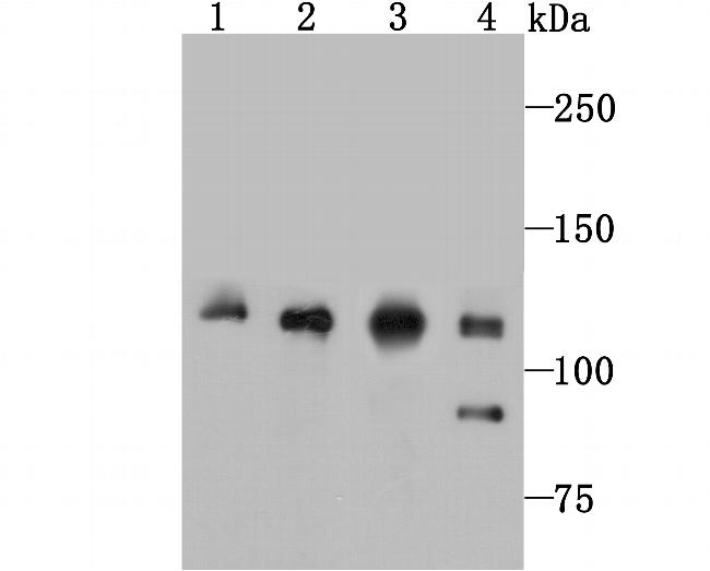 Vinculin Recombinant Monoclonal Antibody (JM42-43) (MA5-45007)