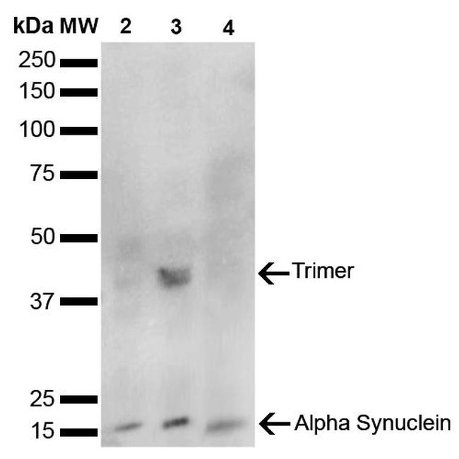 alpha Synuclein Monoclonal Antibody (10H7), FITC (MA5-45841)