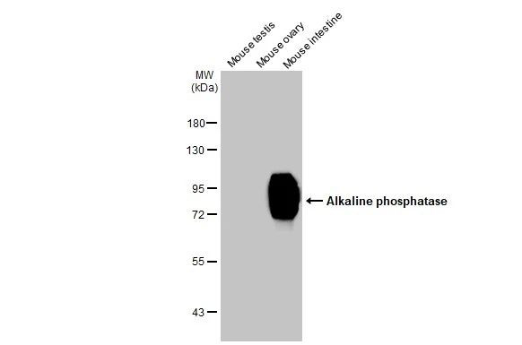 Intestinal Alkaline Phosphatase Recombinant Monoclonal Antibody (HL1268 ...