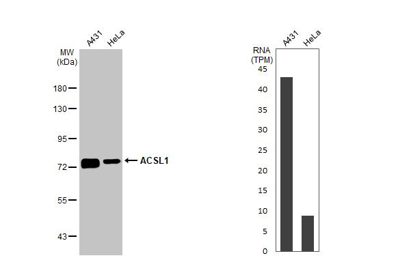 ACSL1 Recombinant Monoclonal Antibody (HL1530) (MA5-47083)