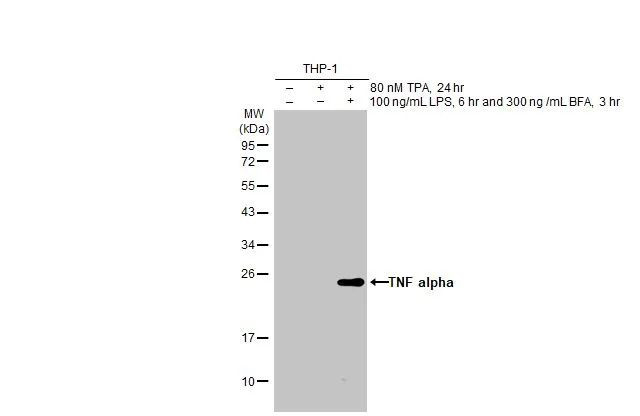 TNF alpha Recombinant Monoclonal Antibody (HL1579) (MA5-47101)