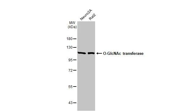 OGT Recombinant Monoclonal Antibody (HL1641) (MA5-47117)