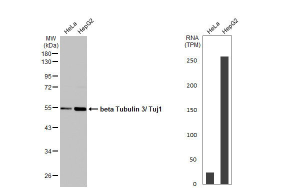 Beta III Tubulin Recombinant Monoclonal Antibody (HL1709) (MA5-47148)