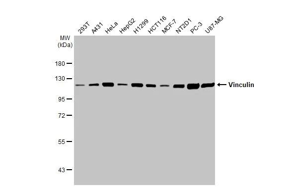 Vinculin Recombinant Monoclonal Antibody (HL1873) (MA5-47210)