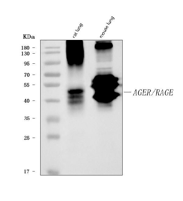 RAGE Monoclonal Antibody (5C6C1) (MA5-49253)