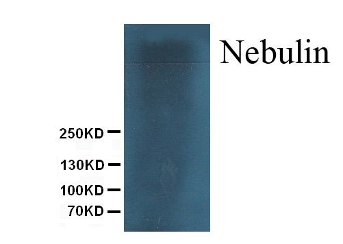 Nebulin Monoclonal Antibody (NB2) (MA5-49308)