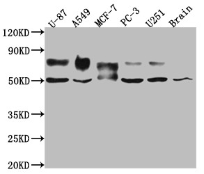 5T4 Recombinant Monoclonal Antibody (6E9) (MA5-49917)