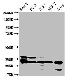 TMEM192 Recombinant Monoclonal Antibody (21G8) (MA5-50066)
