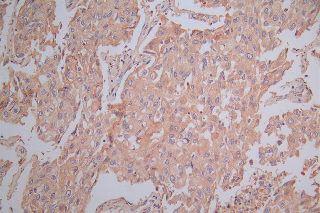 CRACC Recombinant Monoclonal Antibody (7H1) (MA5-50260)