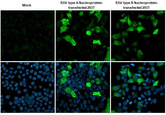 RSV NP Recombinant Monoclonal Antibody (HL1248) (MA5-50309)