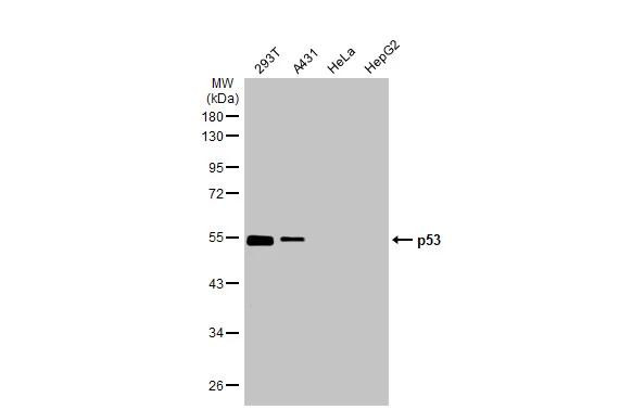 p53 Recombinant Monoclonal Antibody (HL2242) (MA5-50452)