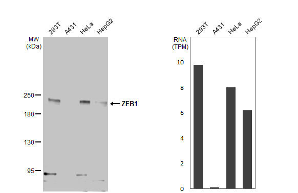 ZEB1 Recombinant Monoclonal Antibody (HL2245) (MA5-50454)